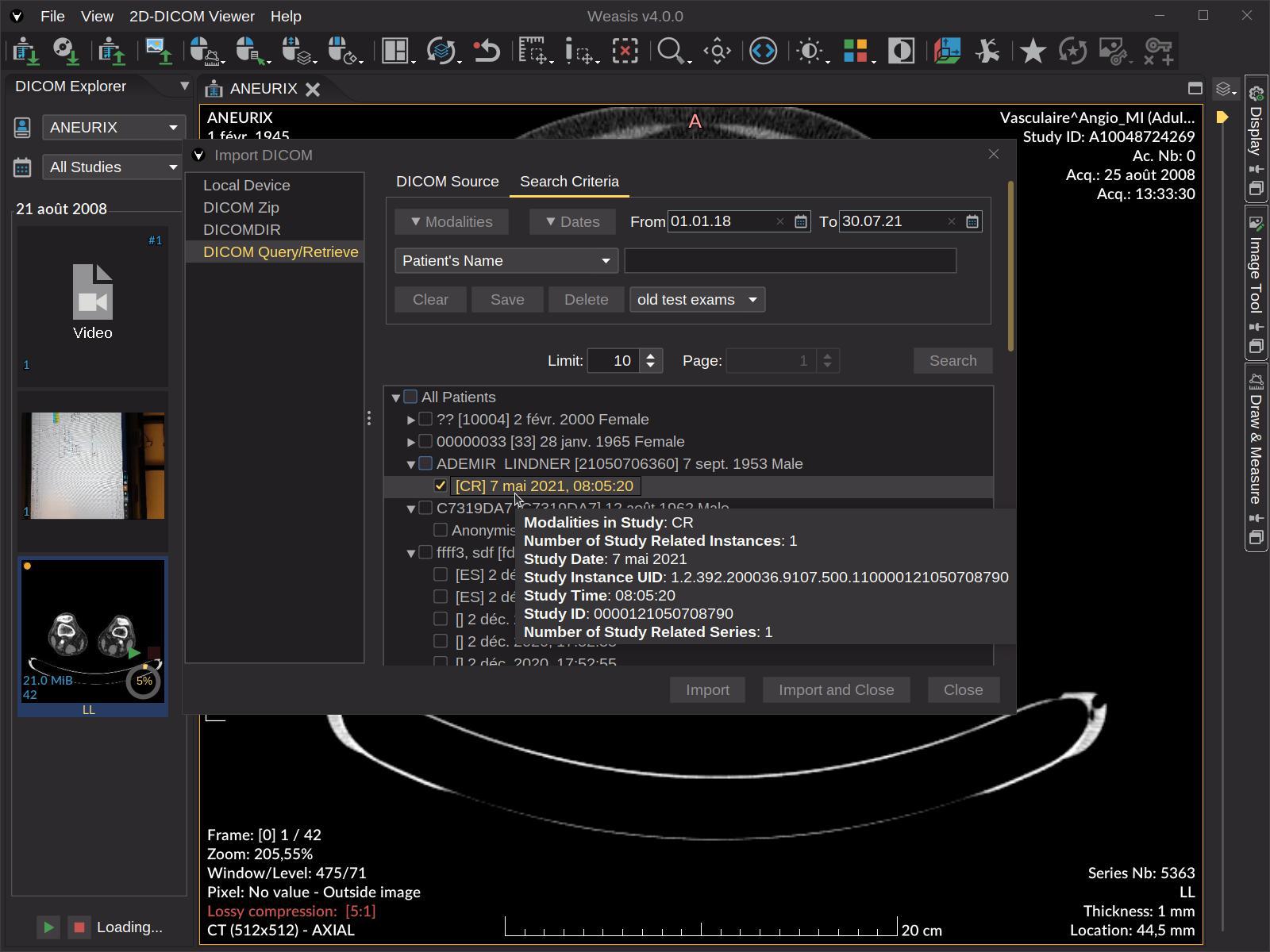 Weasis: Free DICOM viewer :: Weasis Documentation